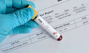 Prostate Cancer in Canada and PSA Testing - Ontario Men's Health